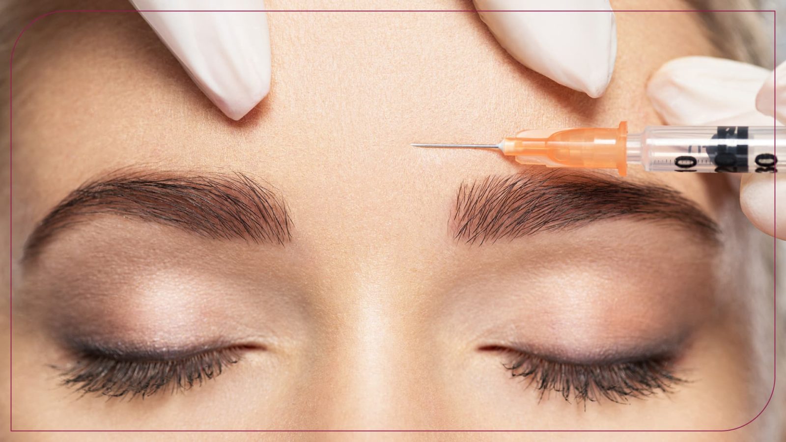 Botox- Liebling der Schönheitsindustrie - the most beautiful